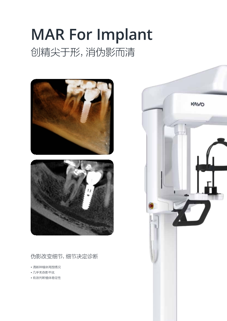 卡瓦 KaVo X-TREND 口腔CBCT影像诊断平台