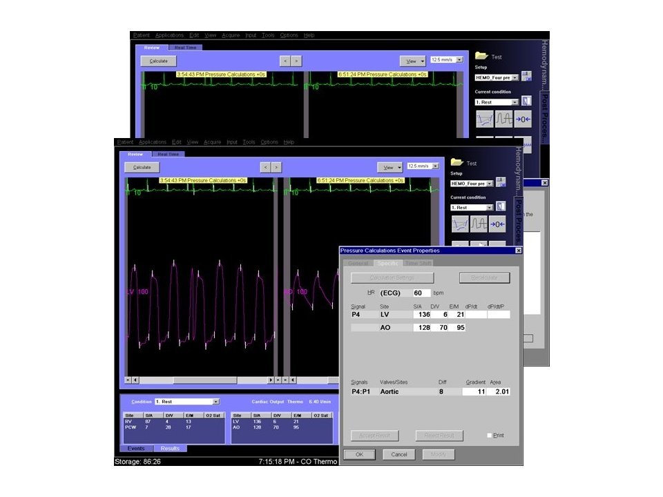 西门子Simens 血管造影机 simens Sensis